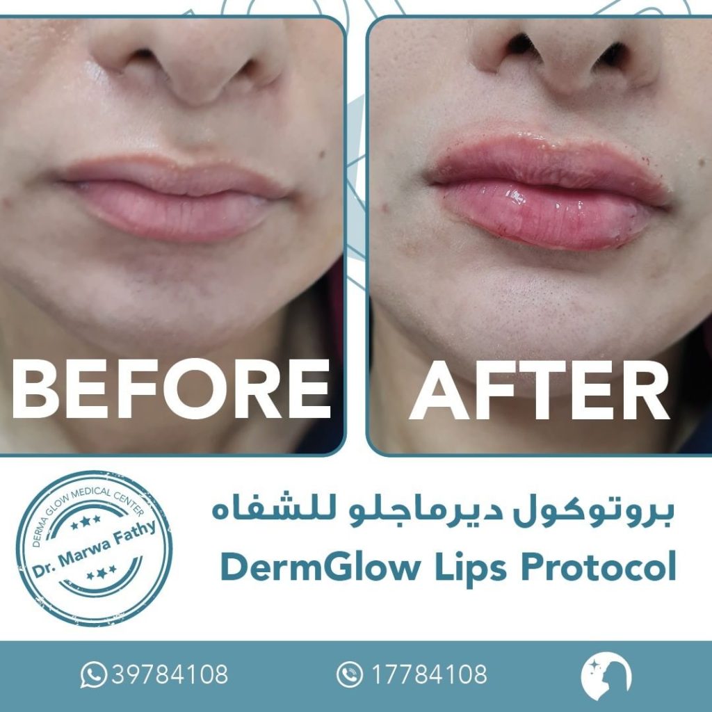 Derma Glow – Derma Glow